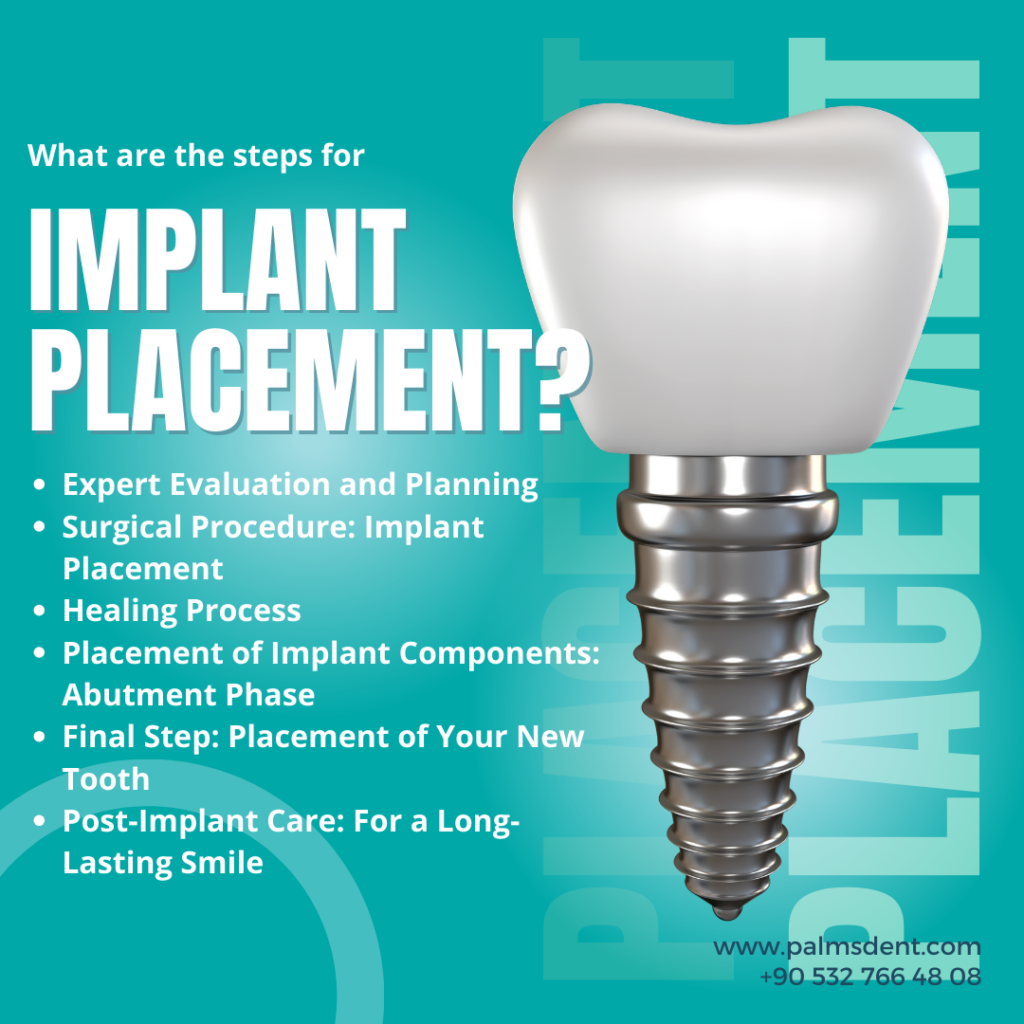 Palms Dent - Leading Dental Clinic in Fethiye